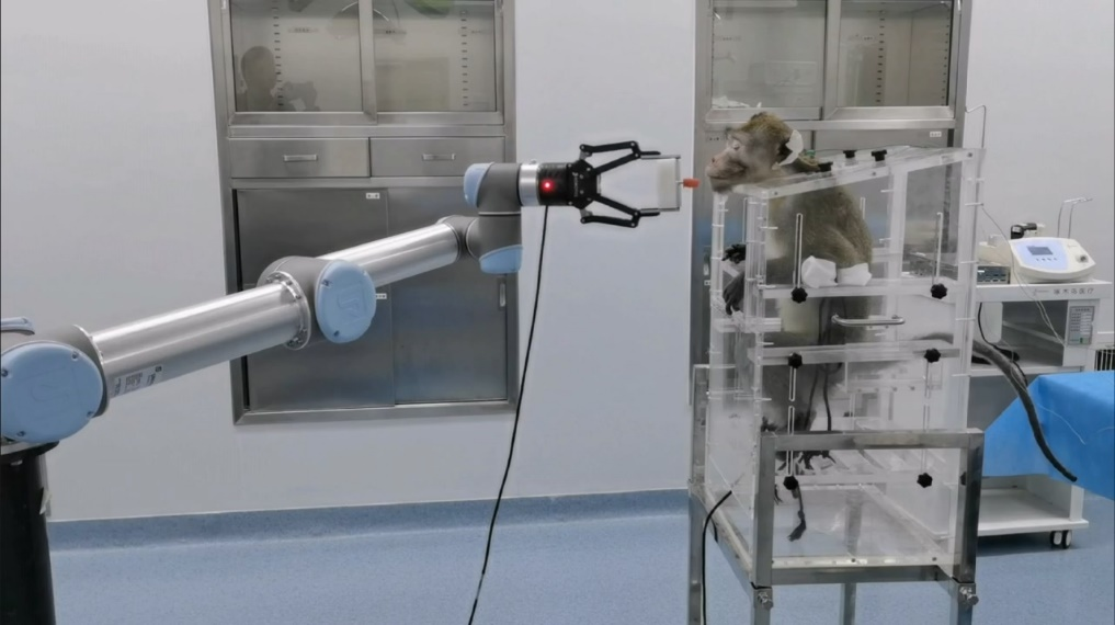The World’s First Interventional Brain Machine Interface Experiment Led ...